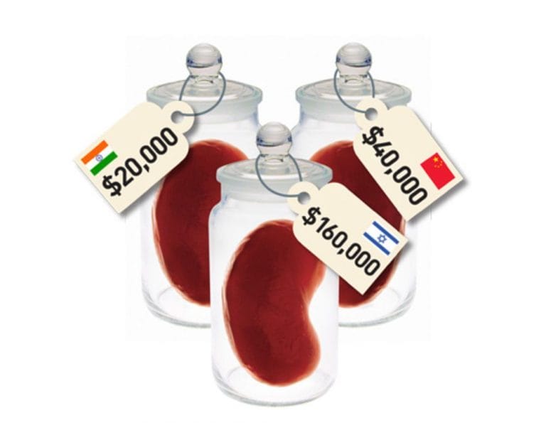 Can You Sell Your Kidney? - Budget and the Bees